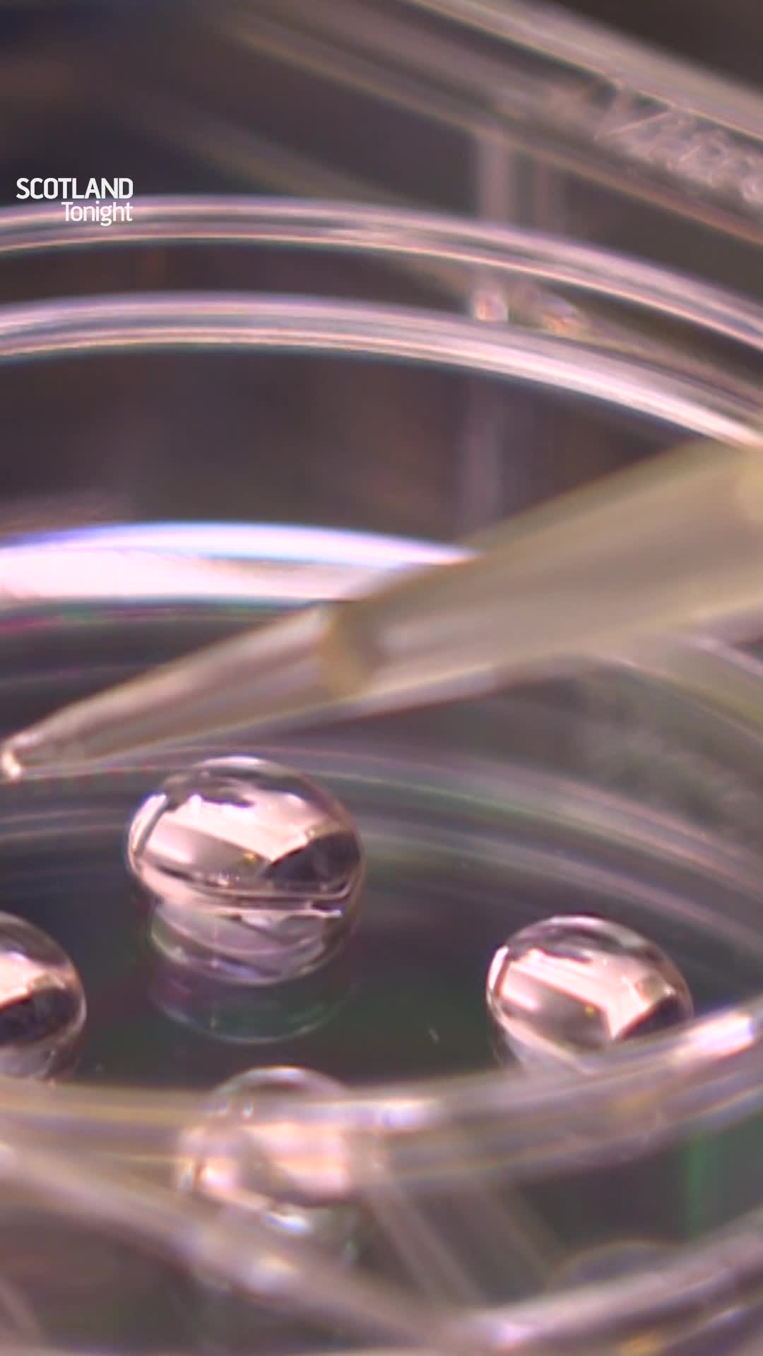 ST-231117-DONOR LAB-9x16