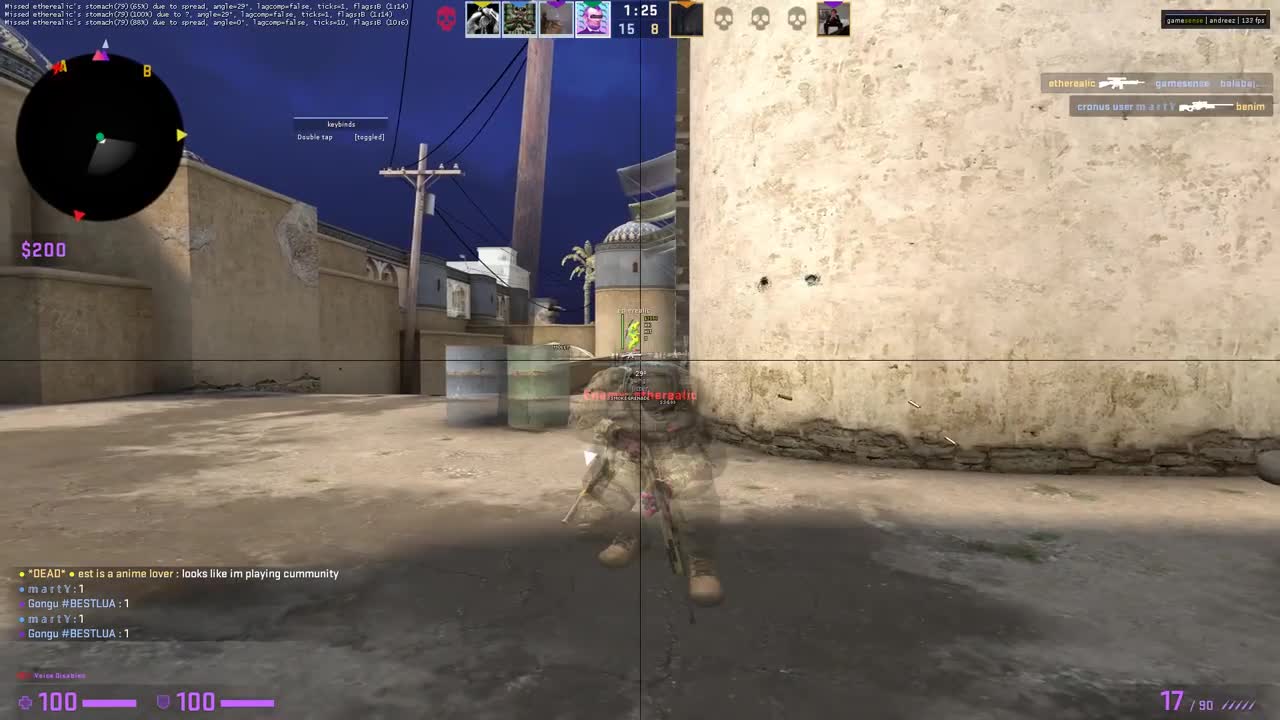 are u serious rn bro