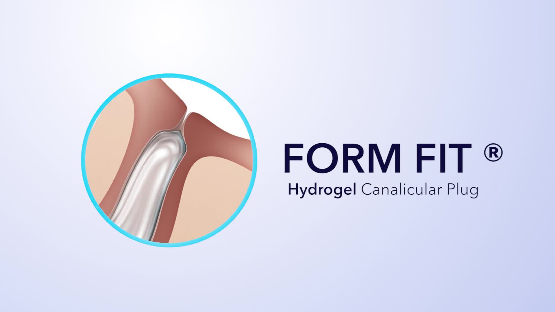 Watch FORM FIT® Hydrogel Instructions For Use Video | Streamable