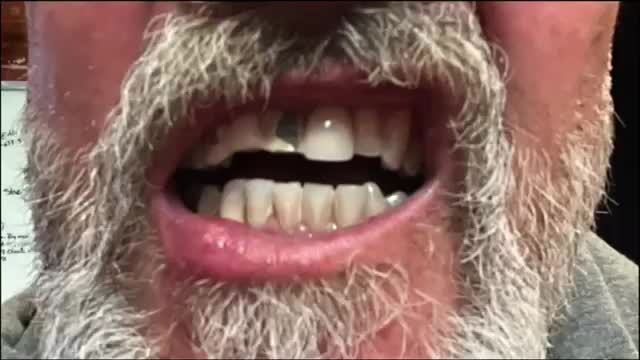 Watch Mercury_Comet_Crash_The_definition_of_Negligence_LOL | Streamable