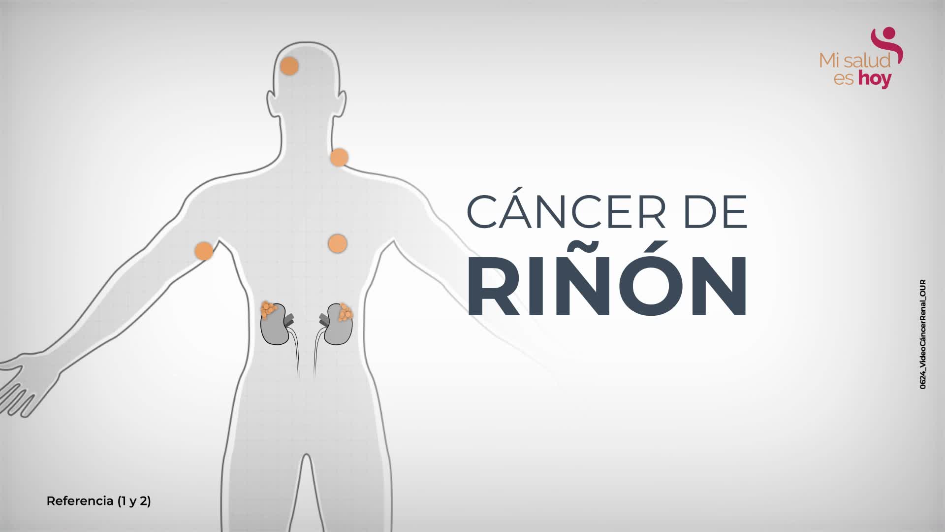 Watch 0624_VideoCáncerRenal_OUR_SUB | Streamable