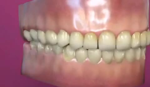 teeth.mp4
