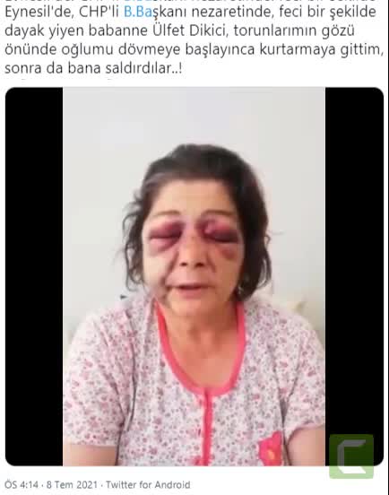 Watch chp eynesil bb Ahmet Latif Karadeniz yasli kadin darp tum aile feci dayak dikta demok ...